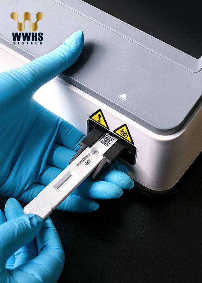 AFP Alpha Fetoprotein Rapid Quantitative Fluorescence Immunoassay Tumor ...